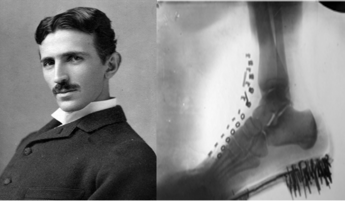 Visaris | DEVELOPMENT AND APPLICATION OF X-RAY TECHNOLOGY AMONG SERBS ...